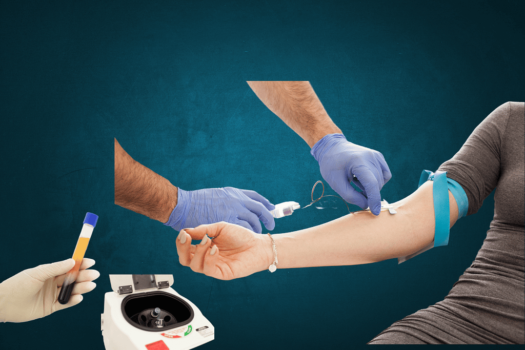 PRP Injection Effective Treatment Spine Dr 02379 Dr Algendy